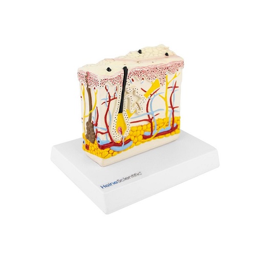 Psoriasis Model - Human Organ Anatomy Models | Surgical Instruments ...